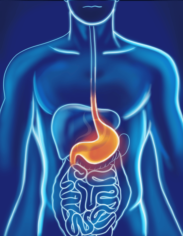 Acid Reflux Medication And Heartburn Treatment Options